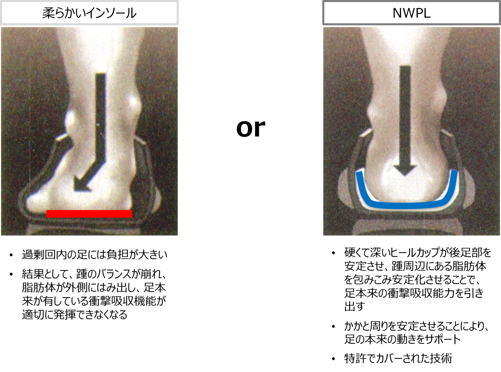 NWPL社のファンクショナルオーソティックス®およびファンクショナルインソールの5つの特長 - ashinavi