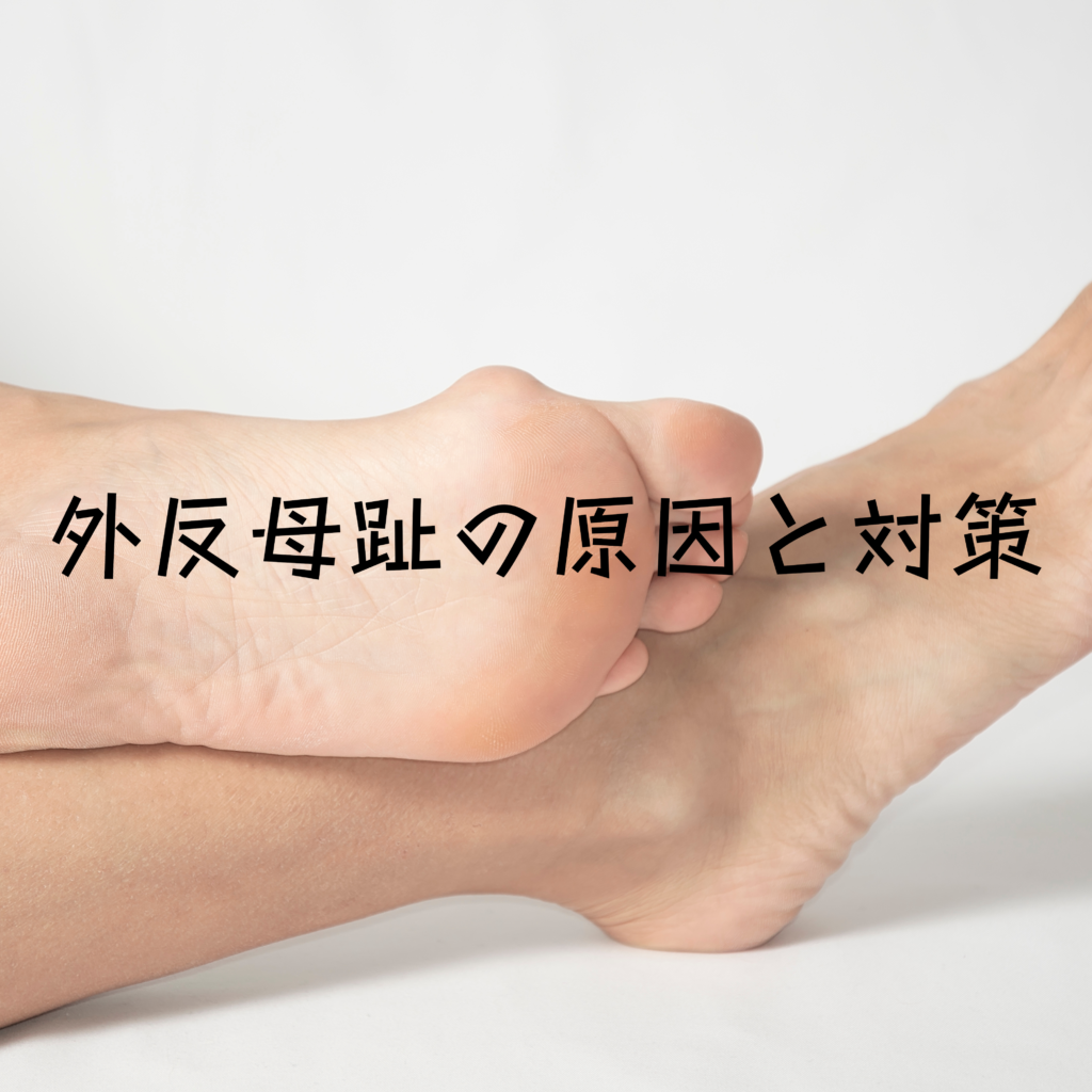 外反母趾の根本的な原因とその対策：NWPLのファンクショナルインソールが最も得意とする領域のひとつ - ashinavi